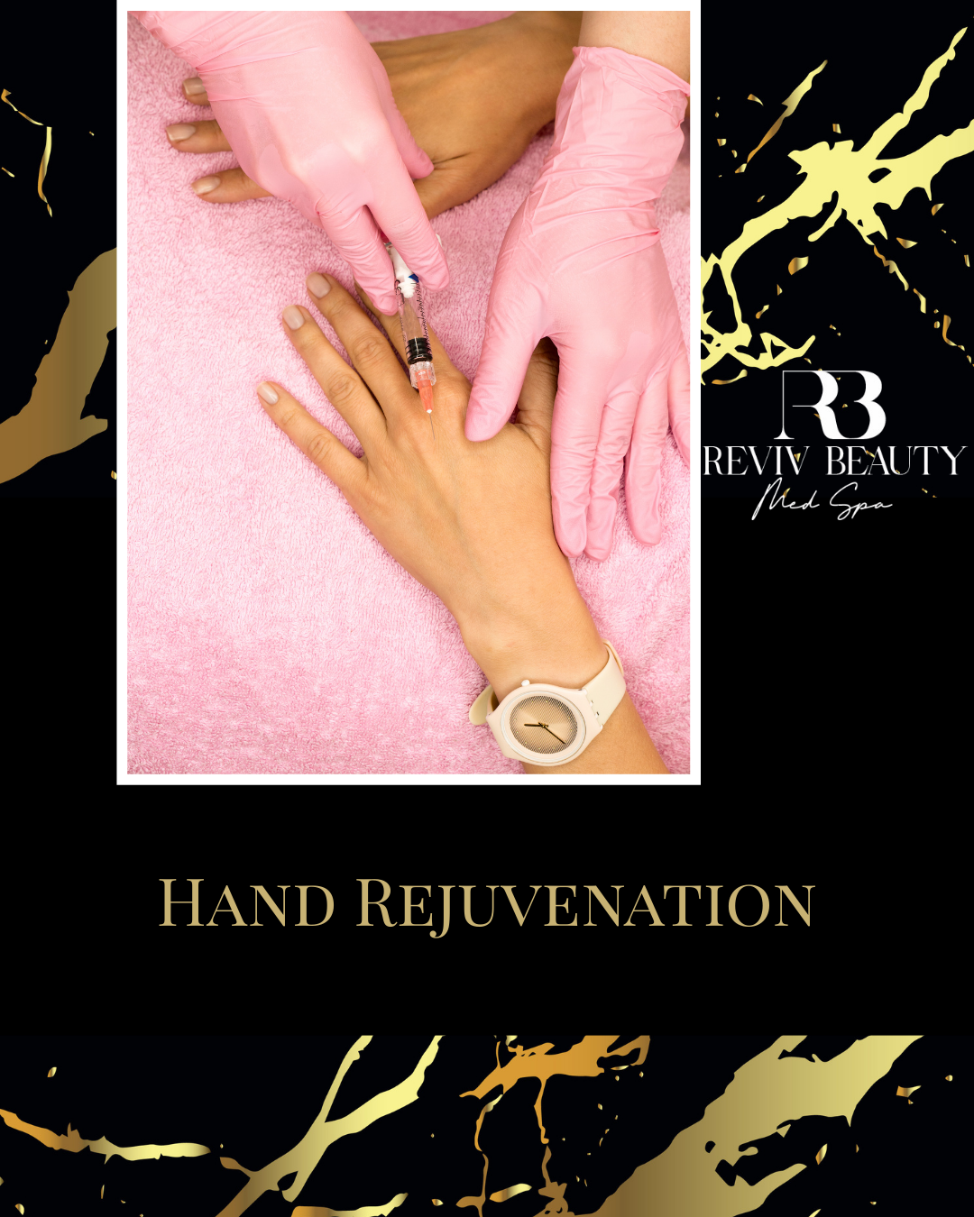 Hand Rejuvenation In Sanford, FL | RevivGLOW Filler Treatment